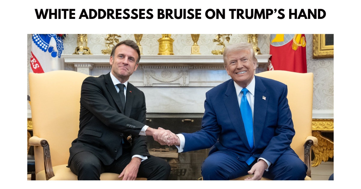 White House Explains Trump's Bruised Hand During Meeting With Macron ...